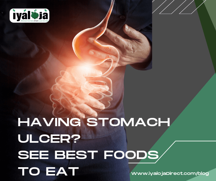 Best Foods To Eat For Stomach Ulcers - Iyaloja Direct